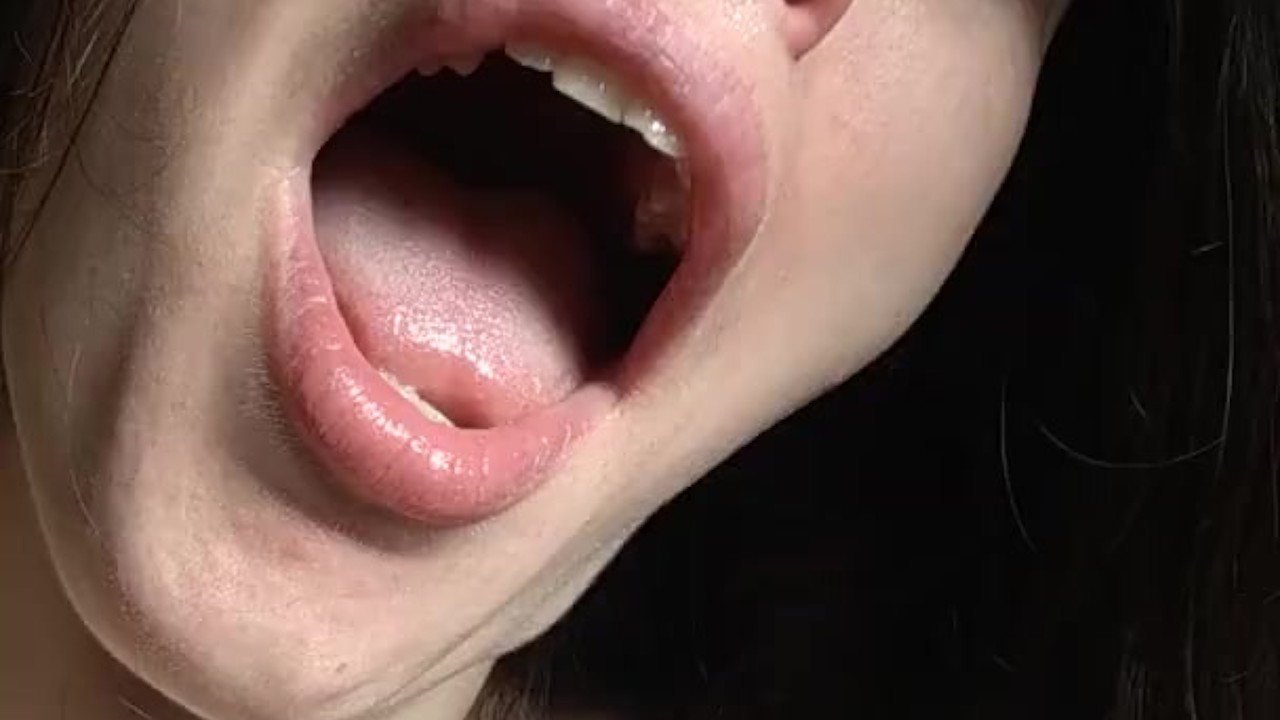 Pimple Popping Spontaneously Orgasming Crazy Camgirl Pinkmoonlust Pops Pimples Face And Talks