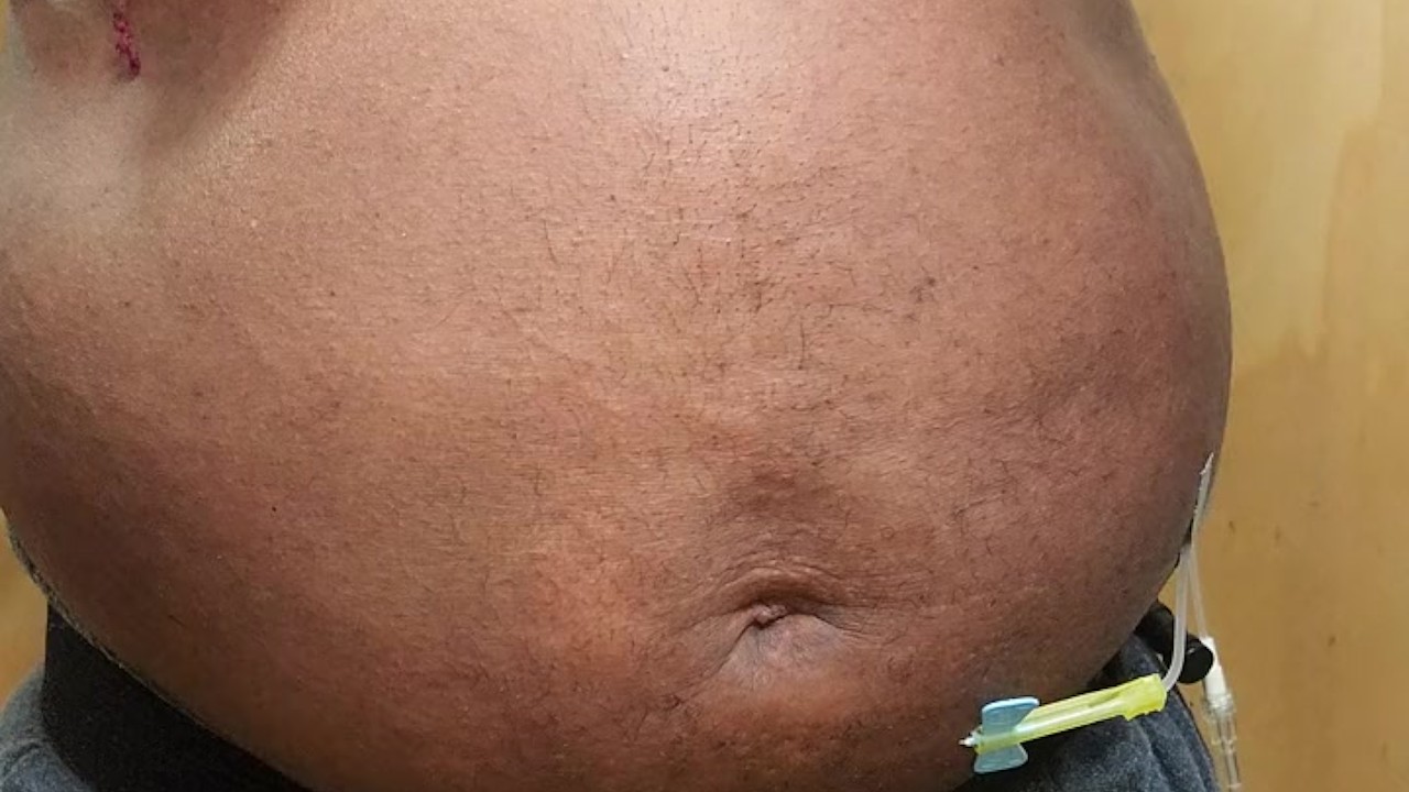 N2o Belly Inflation Free Sex Video Redtube